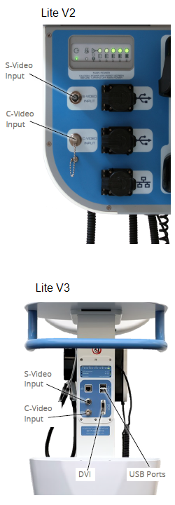 Auxiliary Video Ports
